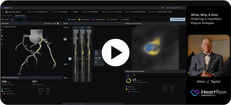 Plaque Analysis Guide | Heartflow